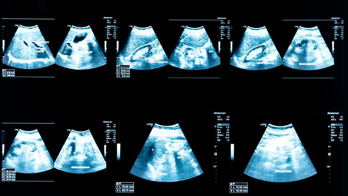 Systematic Review: Ultrasound Goes Echo—Decarbonising Inflammatory ...